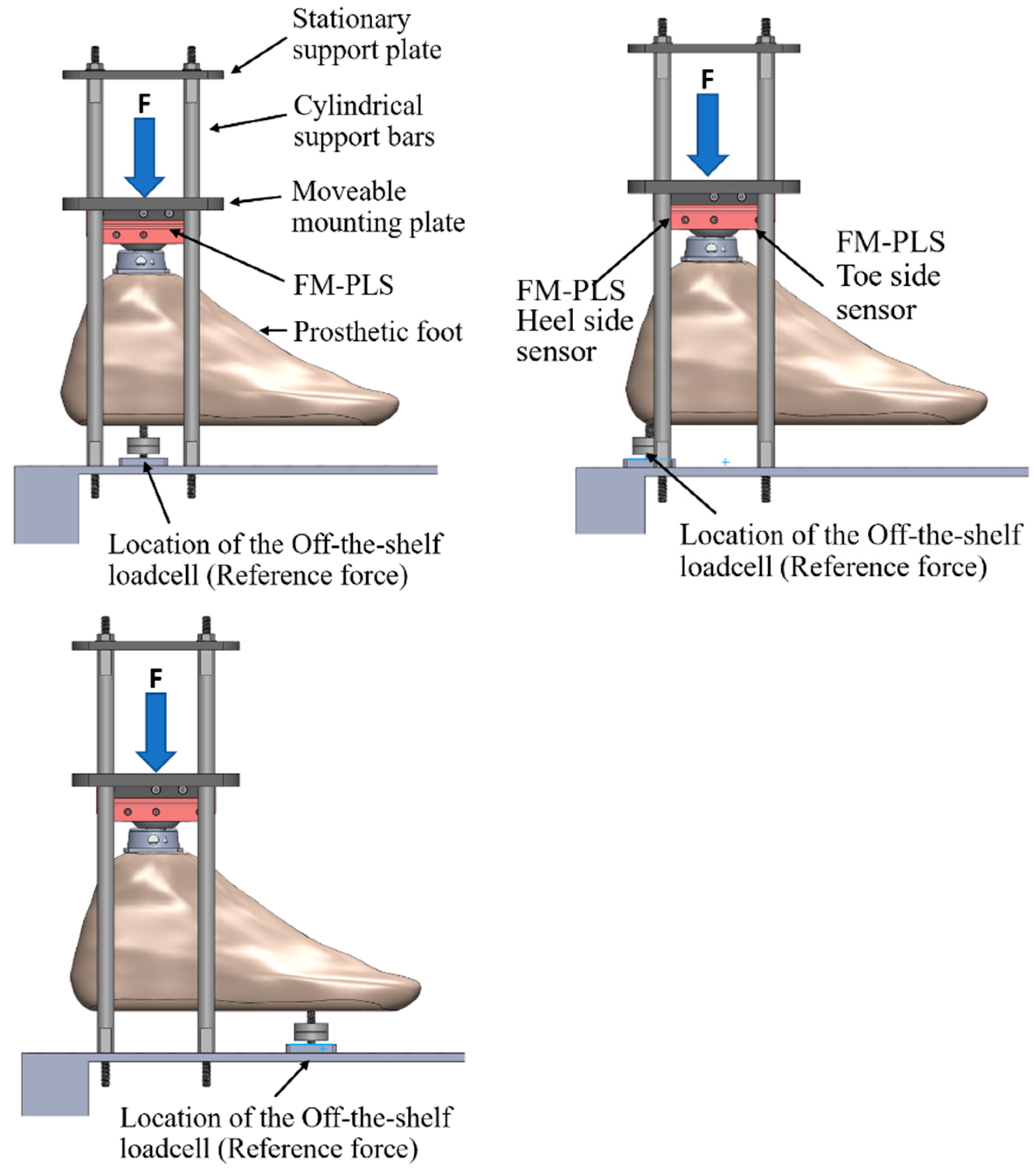 Force-Moment Sensor for Prosthesis Structural Load Measurement