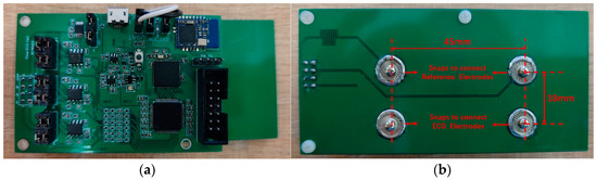 Reduction in the Motion Artifacts in Noncontact ECG Measurements Using ...