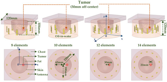 Design of Ultra-Wideband Phased Array Applicator for Breast Cancer ...