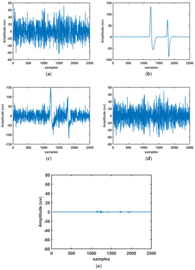 Circulant Singular Spectrum Analysis and Discrete Wavelet Transform for ...