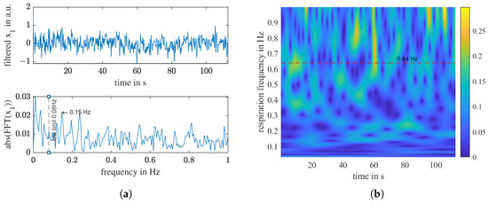 Frequency Comb-Based Ground-Penetrating Bioradar: System Implementation ...