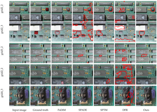 Sensors | Free Full-Text | Image-Based Detection of Modifications in Assembled PCBs with Deep ...