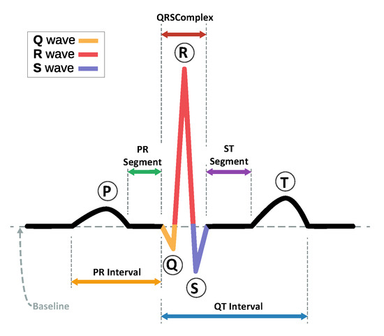 A Tiny Matched Filter-Based CNN for Inter-Patient ECG Classification ...