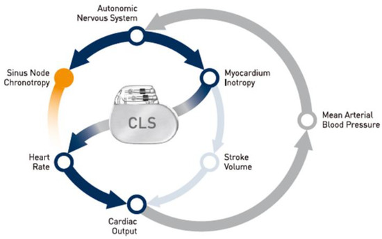 Rate-Responsive Cardiac Pacing: Technological Solutions and Their ...