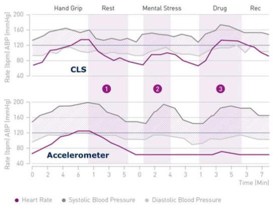 Rate-Responsive Cardiac Pacing: Technological Solutions and Their ...