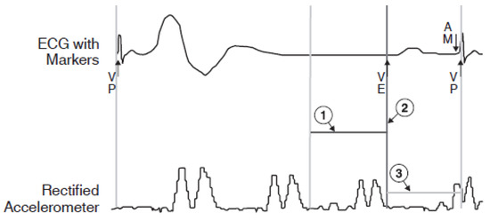 Rate-Responsive Cardiac Pacing: Technological Solutions and Their ...