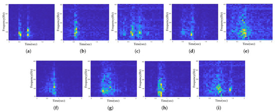 sEMG-Based Hand Gesture Recognition Using Binarized Neural Network