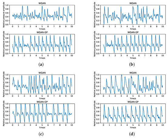 Sensors | Free Full-Text | Towards Generating Realistic Wrist Pulse ...