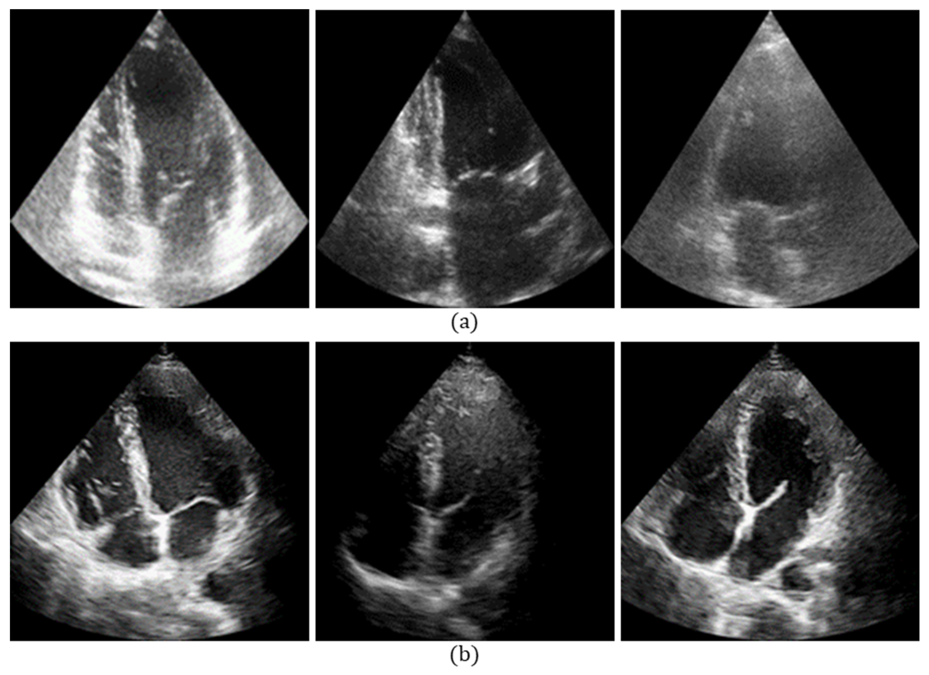 Cross-Domain Echocardiography Segmentation with Multi-Space Joint Adaptation