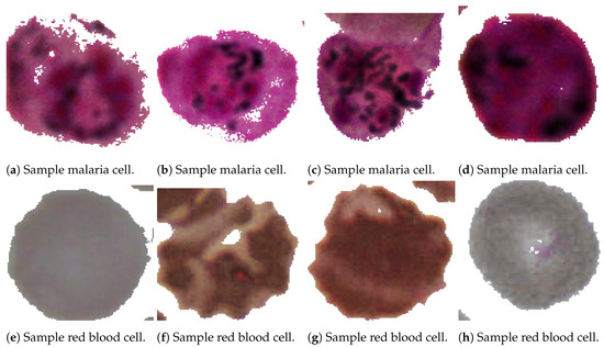 Malaria Detection Using Advanced Deep Learning Architecture