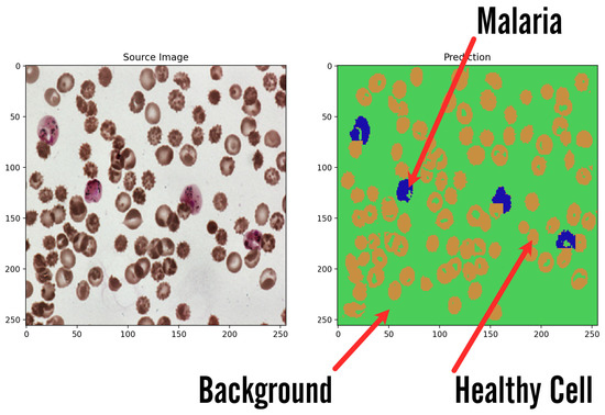 Malaria Detection Using Advanced Deep Learning Architecture