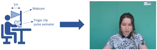 Contactless Cardiovascular Assessment by Imaging Photoplethysmography ...