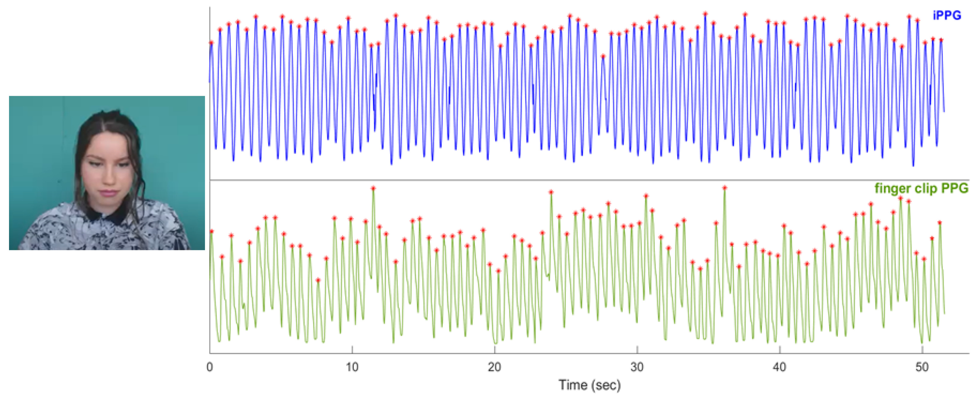 Sensors | Free Full-Text | Contactless Cardiovascular Assessment by ...