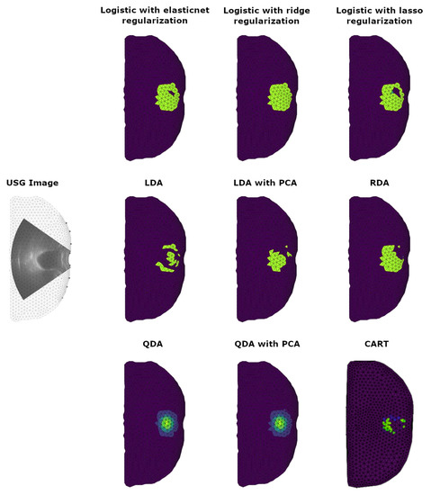Application of Machine Learning Algorithms to the Discretization Problem in Wearable Electrical ...