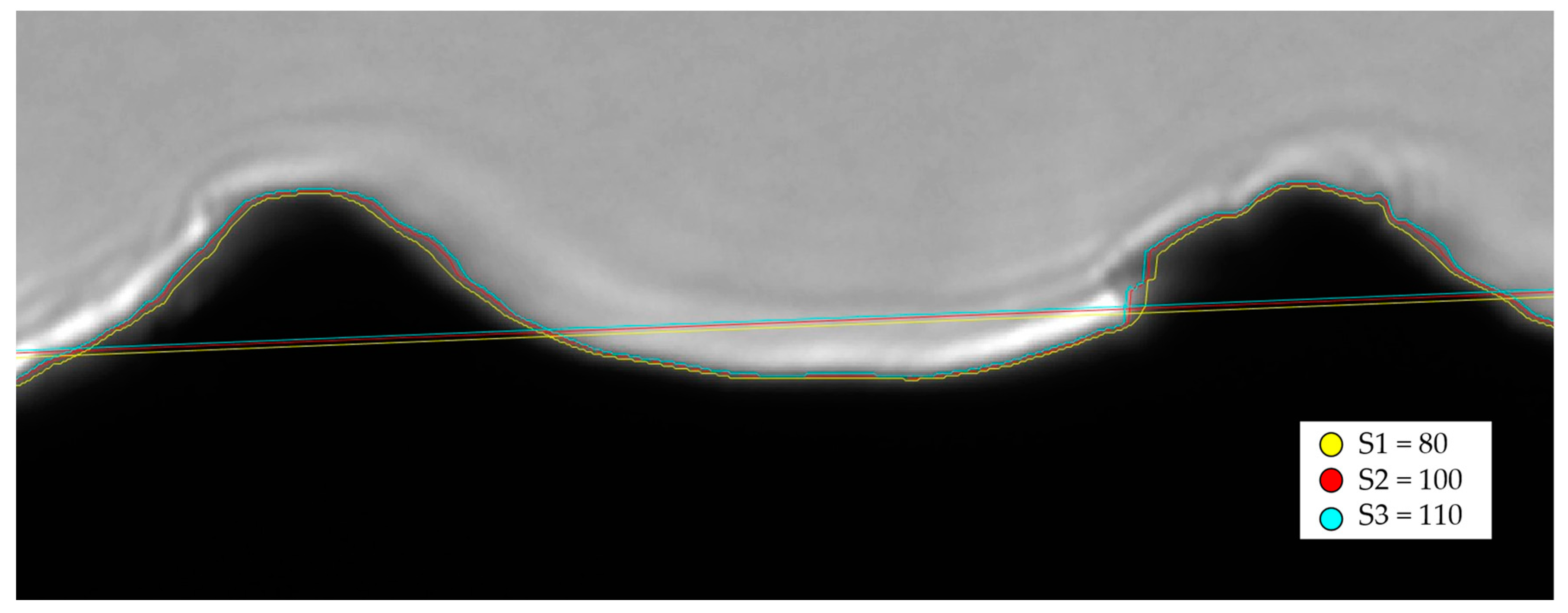 Design and Metrological Analysis of a Backlit Vision System for Surface ...