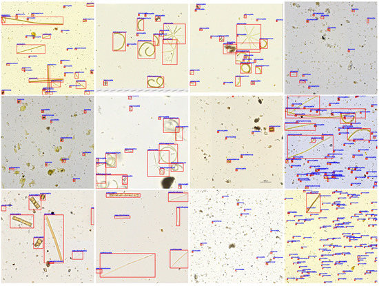 An Efficient Self-Organized Detection System for Algae