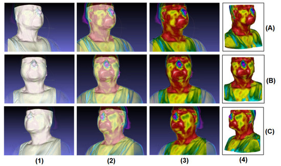 3D Multi-Modality Medical Imaging: Combining Anatomical and Infrared ...