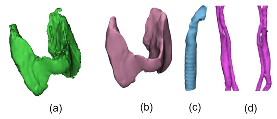 3D Multi-Modality Medical Imaging: Combining Anatomical and Infrared Thermal Images for 3D ...