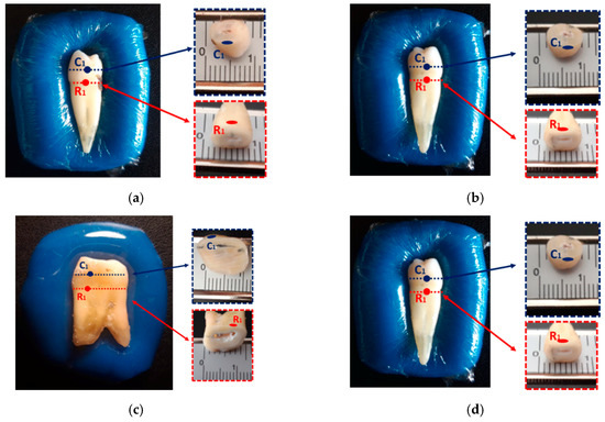 Dielectric Characterization of Healthy Human Teeth from 0.5 to 18 GHz ...