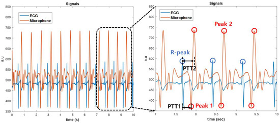 Development of Real-Time Cuffless Blood Pressure Measurement Systems ...