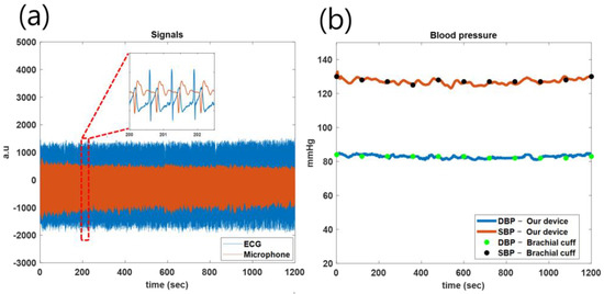 Development of Real-Time Cuffless Blood Pressure Measurement Systems ...