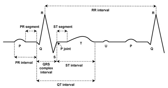 ECG Classification Using an Optimal Temporal Convolutional Network for Remote Health Monitoring