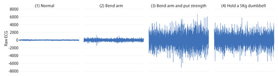 PPG2EMG: Estimating Upper-Arm Muscle Activities and EMG from Wrist PPG ...