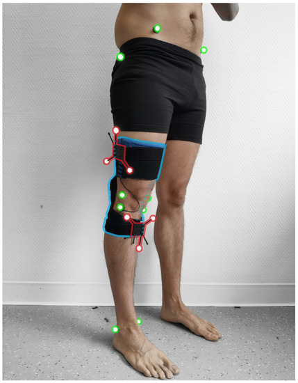 Sensors | Free Full-Text | Validation of 3D Knee Kinematics during Gait ...
