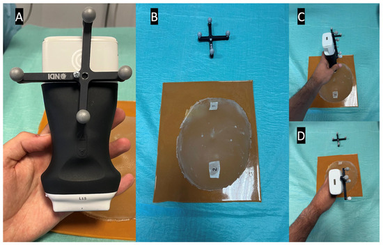 Augmented Reality-Assisted Ultrasound Breast Biopsy