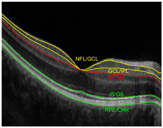 Neural Networks Application for Accurate Retina Vessel Segmentation ...