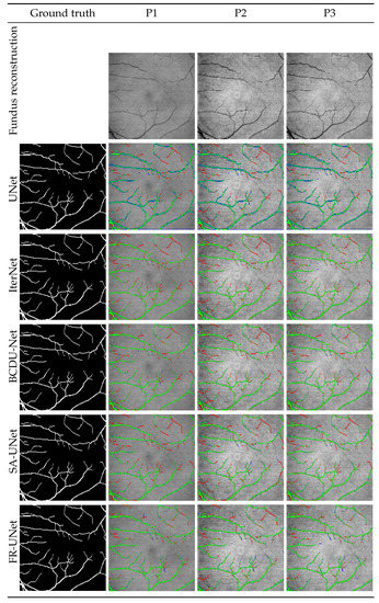 Neural Networks Application for Accurate Retina Vessel Segmentation from OCT Fundus Reconstruction