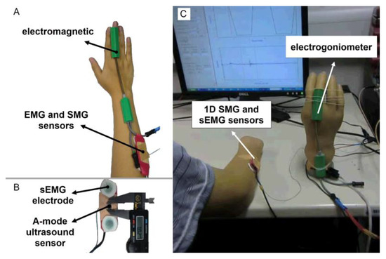 Controlling Upper Limb Prostheses Using Sonomyography (SMG): A Review