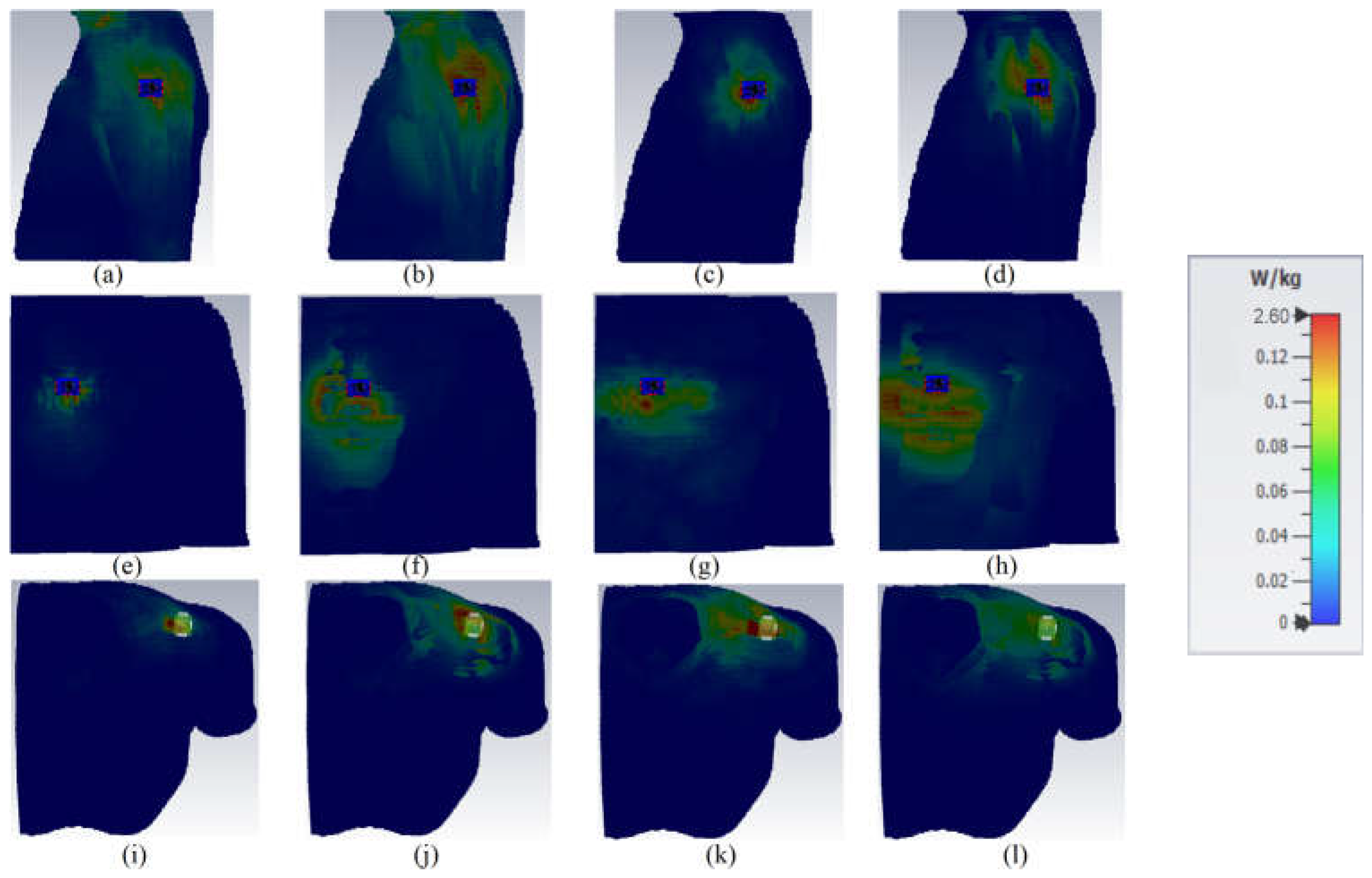 A Miniaturized Full-Ground Dual-Band MIMO Spiral Button Wearable ...