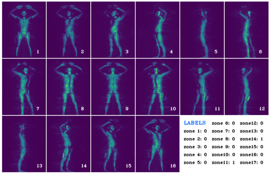 Sensors | Free Full-Text | Weakly Supervised 2D Pose Adaptation and ...