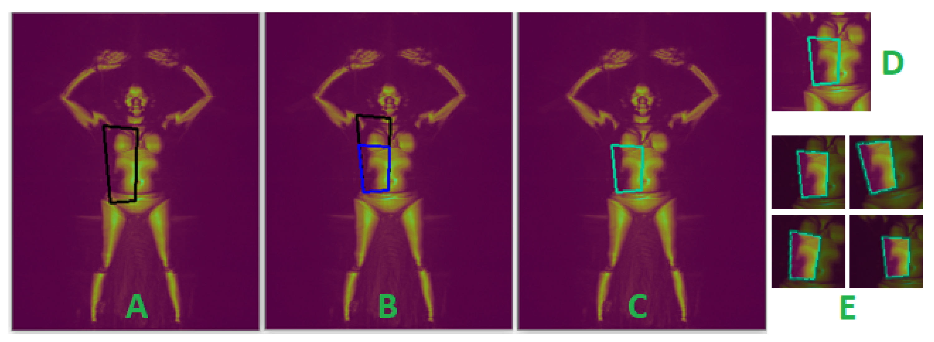 Sensors Free Full Text Weakly Supervised 2d Pose Adaptation And