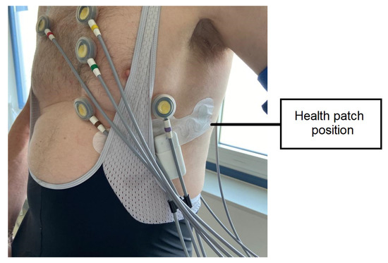Signal Quality Analysis for Long-Term ECG Monitoring Using a Health ...
