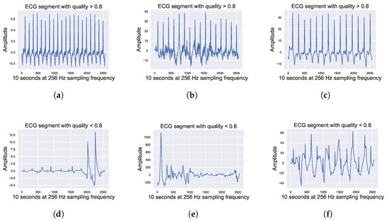 Signal Quality Analysis for Long-Term ECG Monitoring Using a Health ...