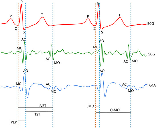 Sensors Free Full Text Heart Rate Variability Analysis On