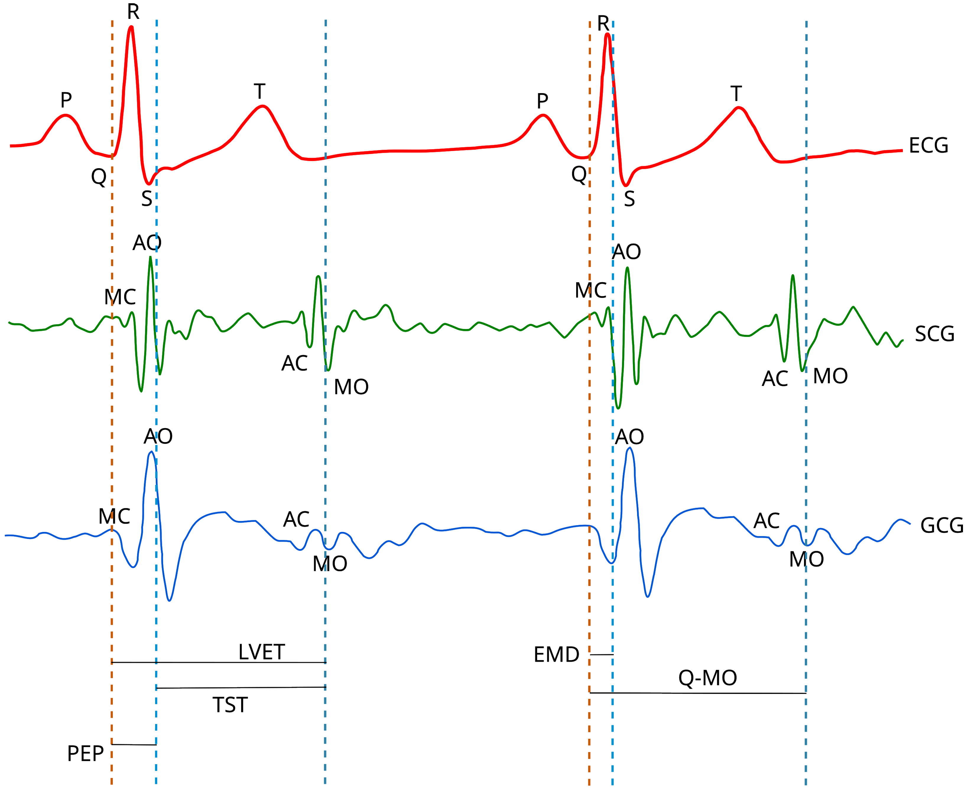 Heart Rate Variability Analysis on Electrocardiograms, Seismocardiograms and Gyrocardiograms of ...