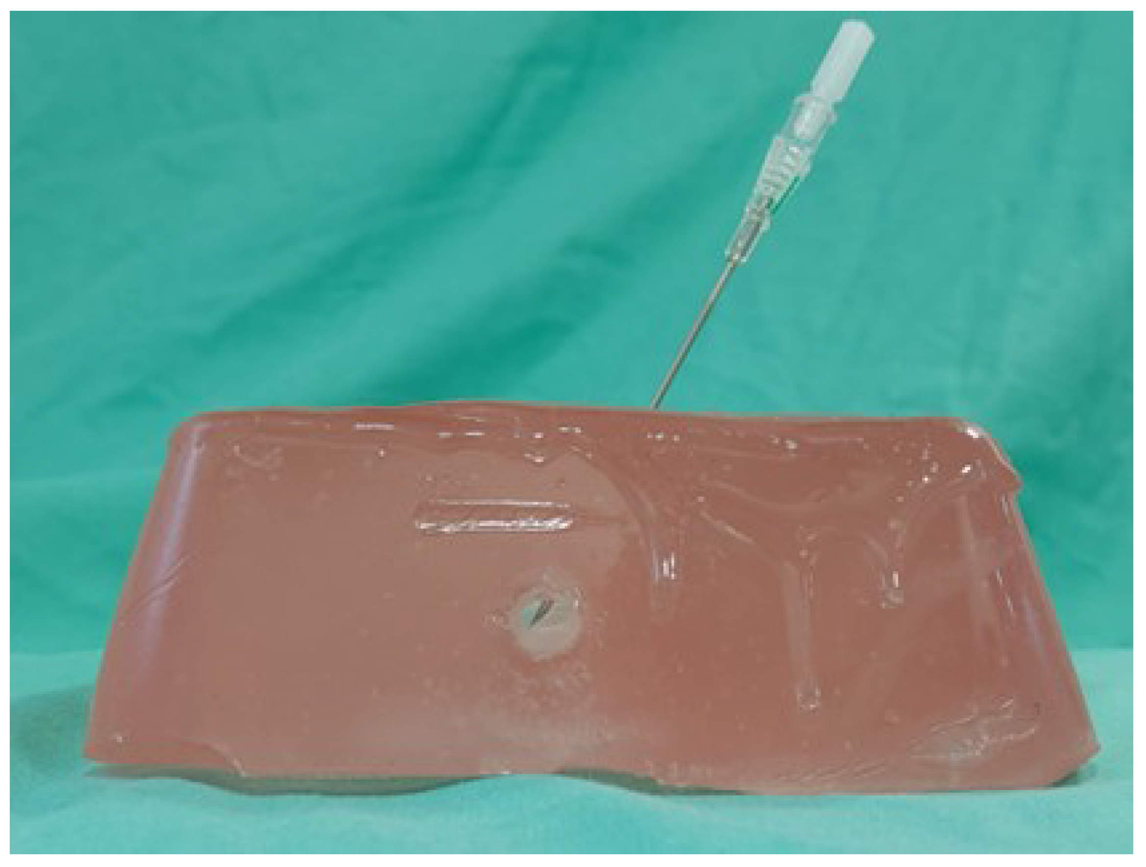 Sensors | Free Full-Text | Augmenting Image-Guided Procedures through ...