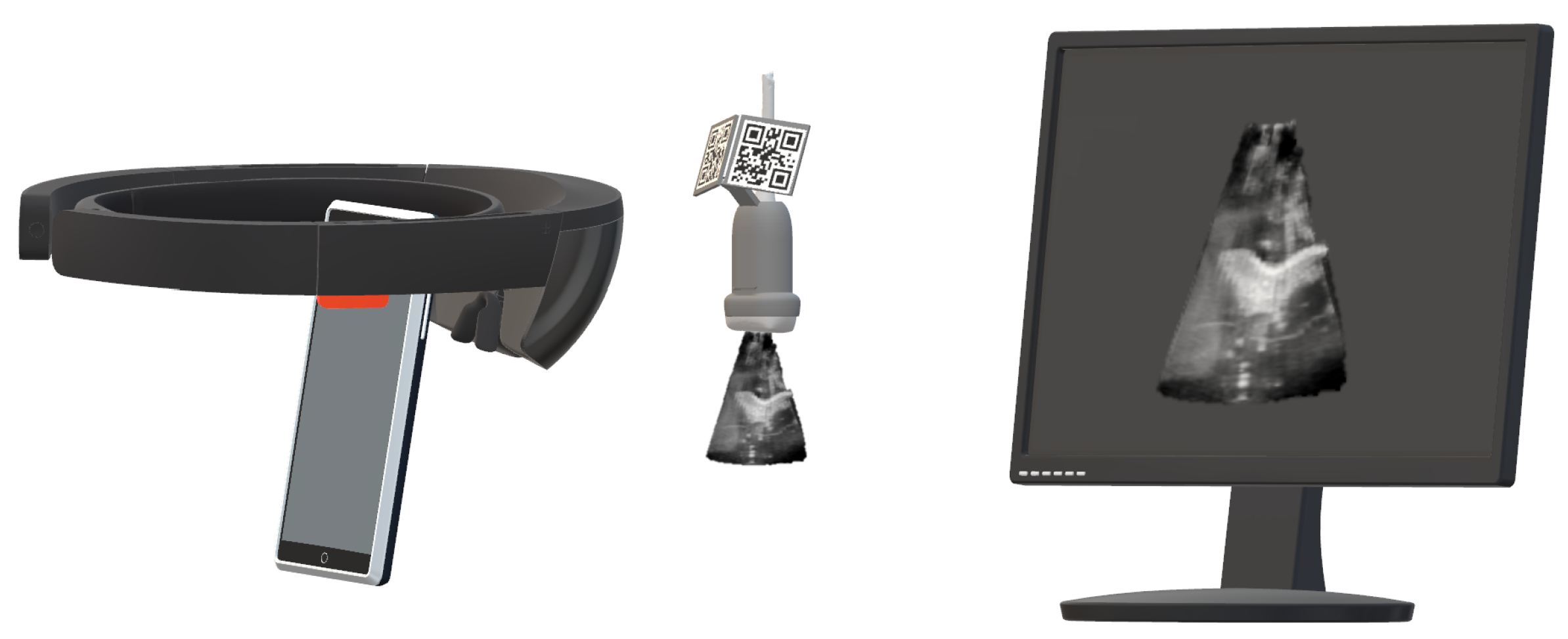 Sensors | Free Full-Text | Augmenting Image-Guided Procedures through ...