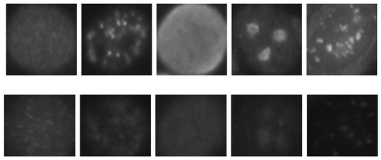 Classification of HEp-2 Staining Pattern Images Using Adapted Multilayer Perceptron Neural ...