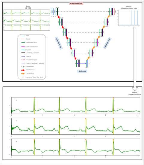 Sensors | Free Full-Text | A Deep Learning Architecture Using 3D Vectorcardiogram to Detect R ...