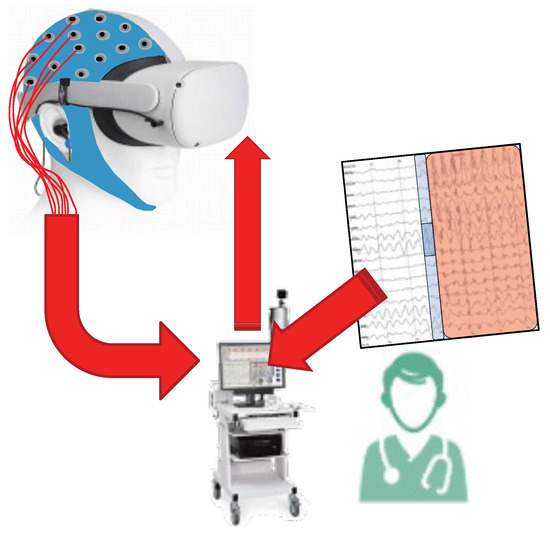 Sensors | Free Full-Text | Data Augmentation Effects on Highly ...