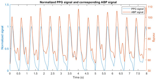 Photoplethysmography Signal Wavelet Enhancement and Novel Features ...