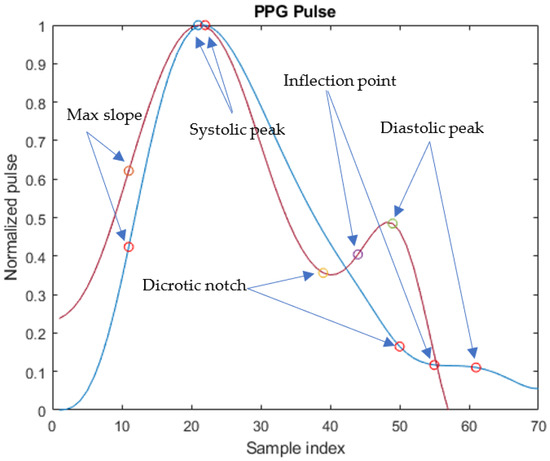 Photoplethysmography Signal Wavelet Enhancement and Novel Features ...