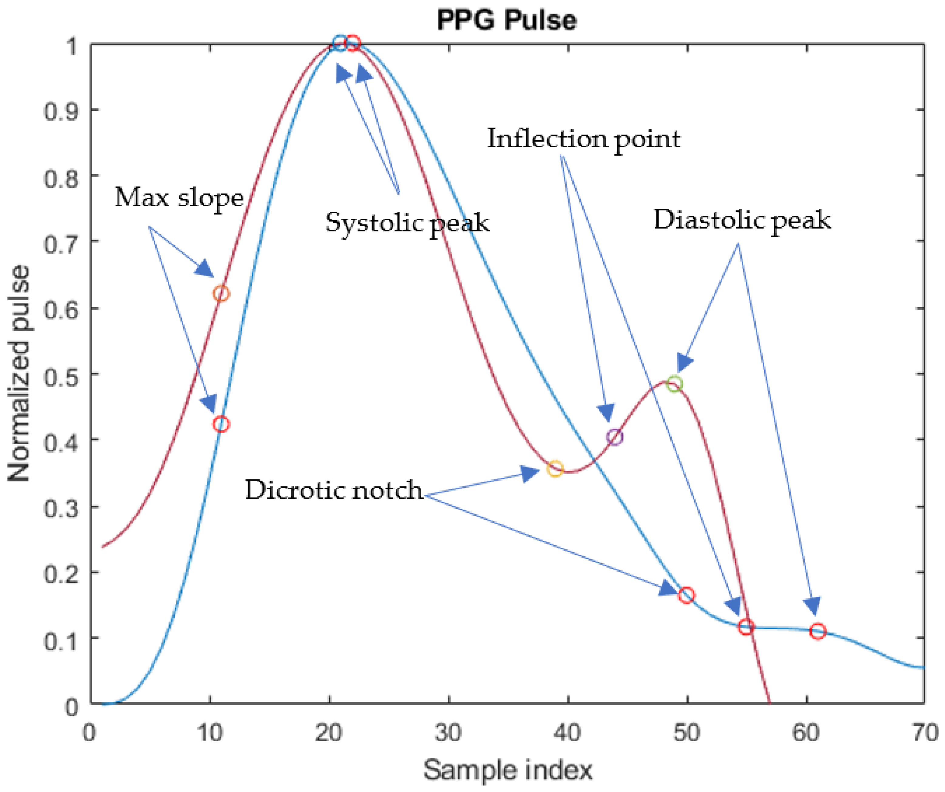 Photoplethysmography Signal Wavelet Enhancement and Novel Features ...