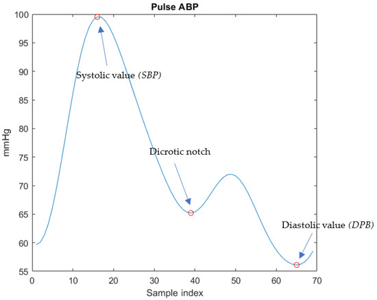 Photoplethysmography Signal Wavelet Enhancement and Novel Features ...