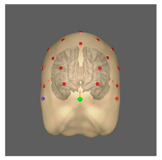 Sensors | Free Full-Text | Source-Space Brain Functional Connectivity Features in ...