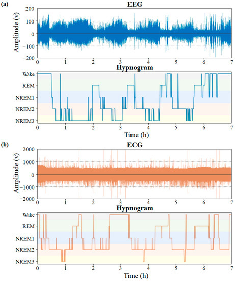 Cross-Domain Transfer of EEG to EEG or ECG Learning for CNN ...